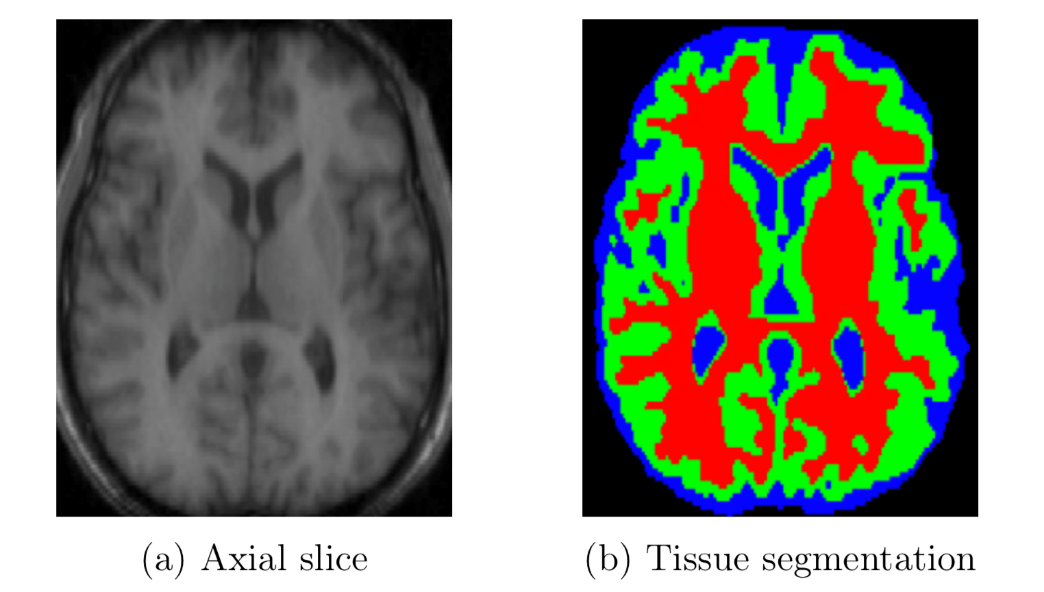 Imaging Examples Brain At Leonard Neil Blog